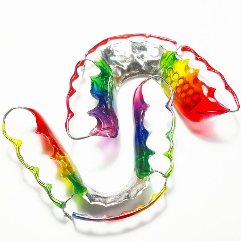 รีเทนเนอร์ มีกี่แบบ แบบไหนดี ราคา 999 ถึง 5,000 บาท ที่นี่